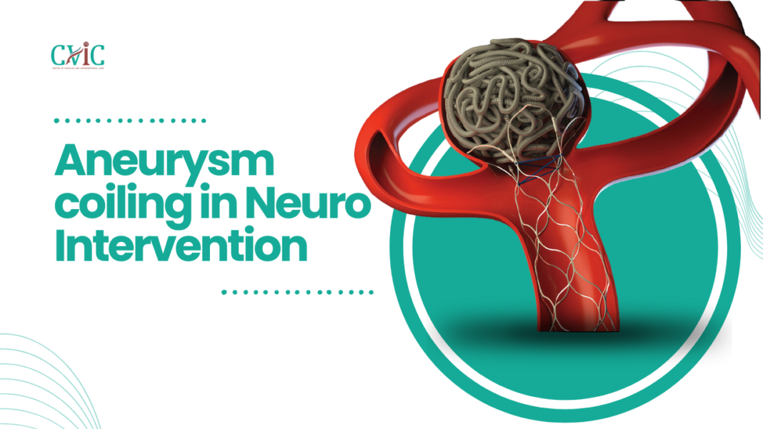 Aneurysm coiling in Neuro Intervention