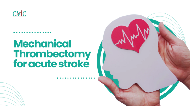 Mechanical Thrombectomy for acute stroke in Neuro Intervention