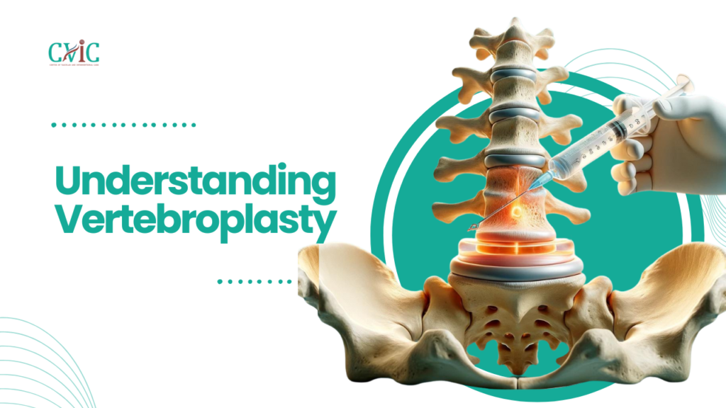 Vertebroplasty: What It Is, Purpose, Procedure & Side Effects