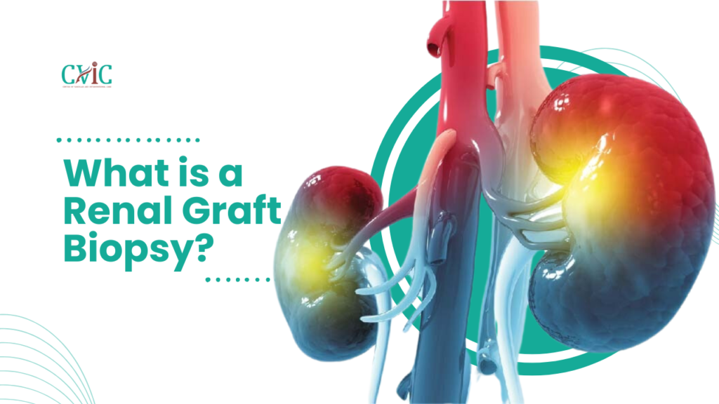 What is a Renal Graft Biopsy?