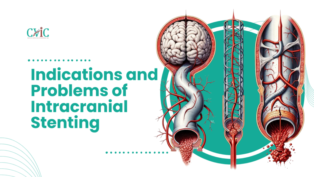 Indications and Problems of Intracranial Stenting