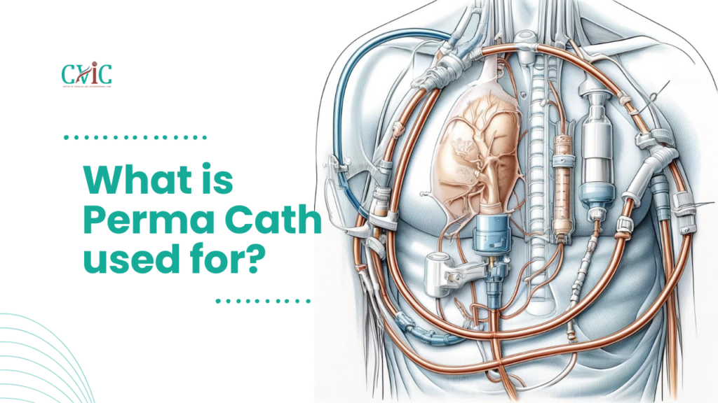 What is Perma Cath used for?
