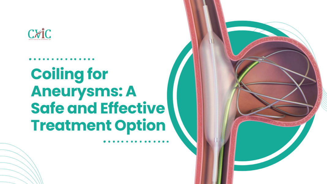 Coiling for Aneurysms: A Safe and Effective Treatment Option