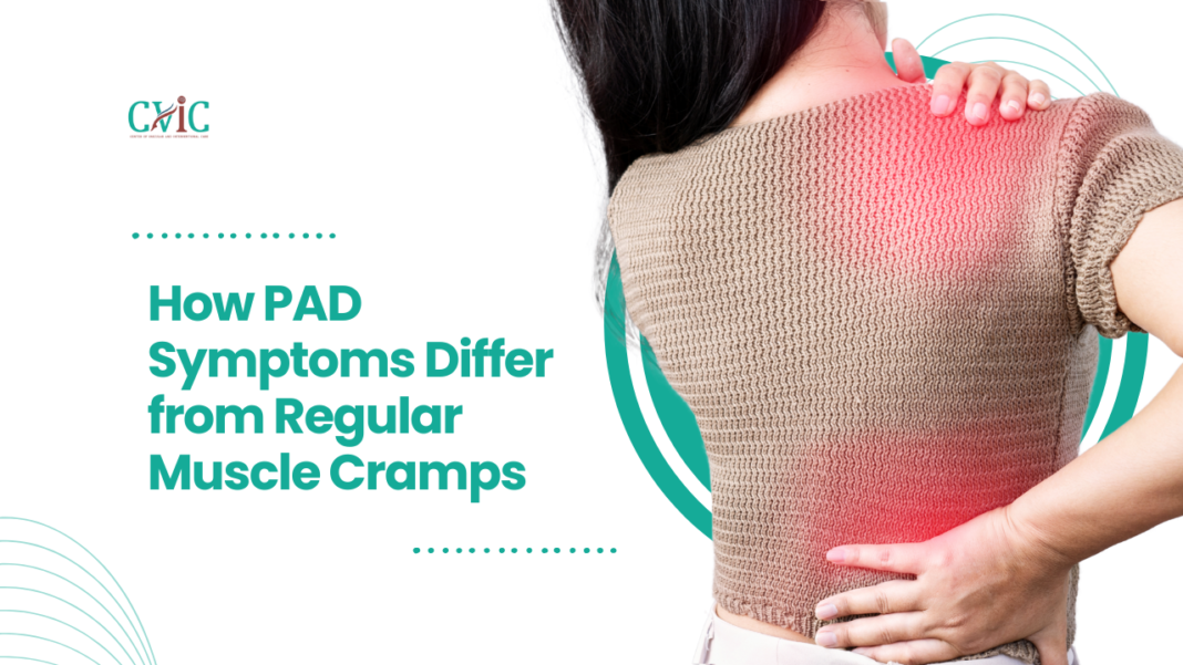 How PAD Symptoms Differ from Regular Muscle Cramps