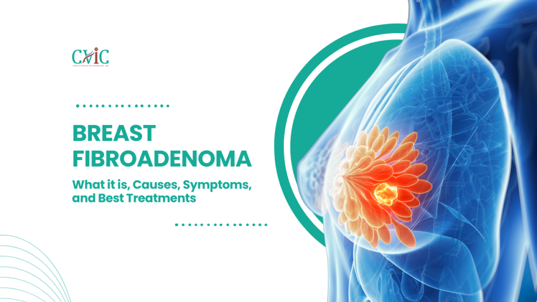 Breast Fibroadenoma: What It Is, Causes, Symptoms, Treatments