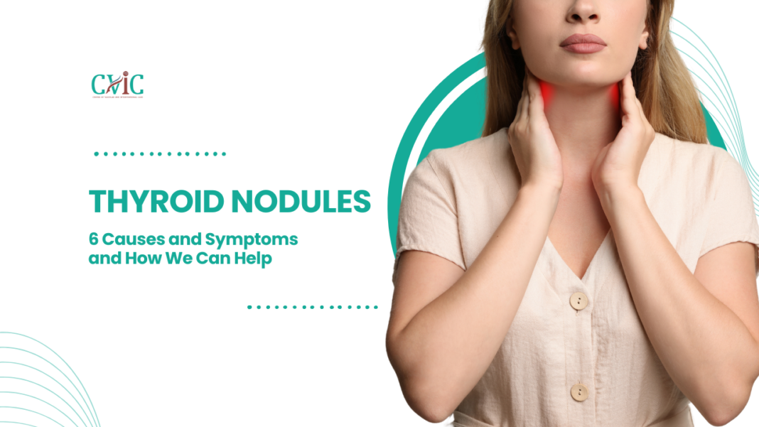 Thyroid Nodules: 6 Causes and Symptoms and How We Can Help