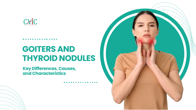 Goiters And Thyroid Nodules: Key Differences, Causes