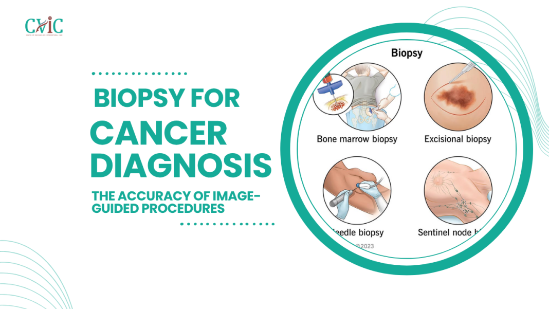 Biopsy for Cancer Diagnosis: The Accuracy of Image-Guided Procedures ...